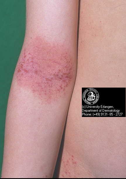 Antecubital Space Tattoo